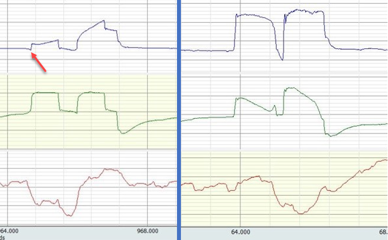 The Toronto Centre Of Excellence In Mechanical Ventilation Reverse
